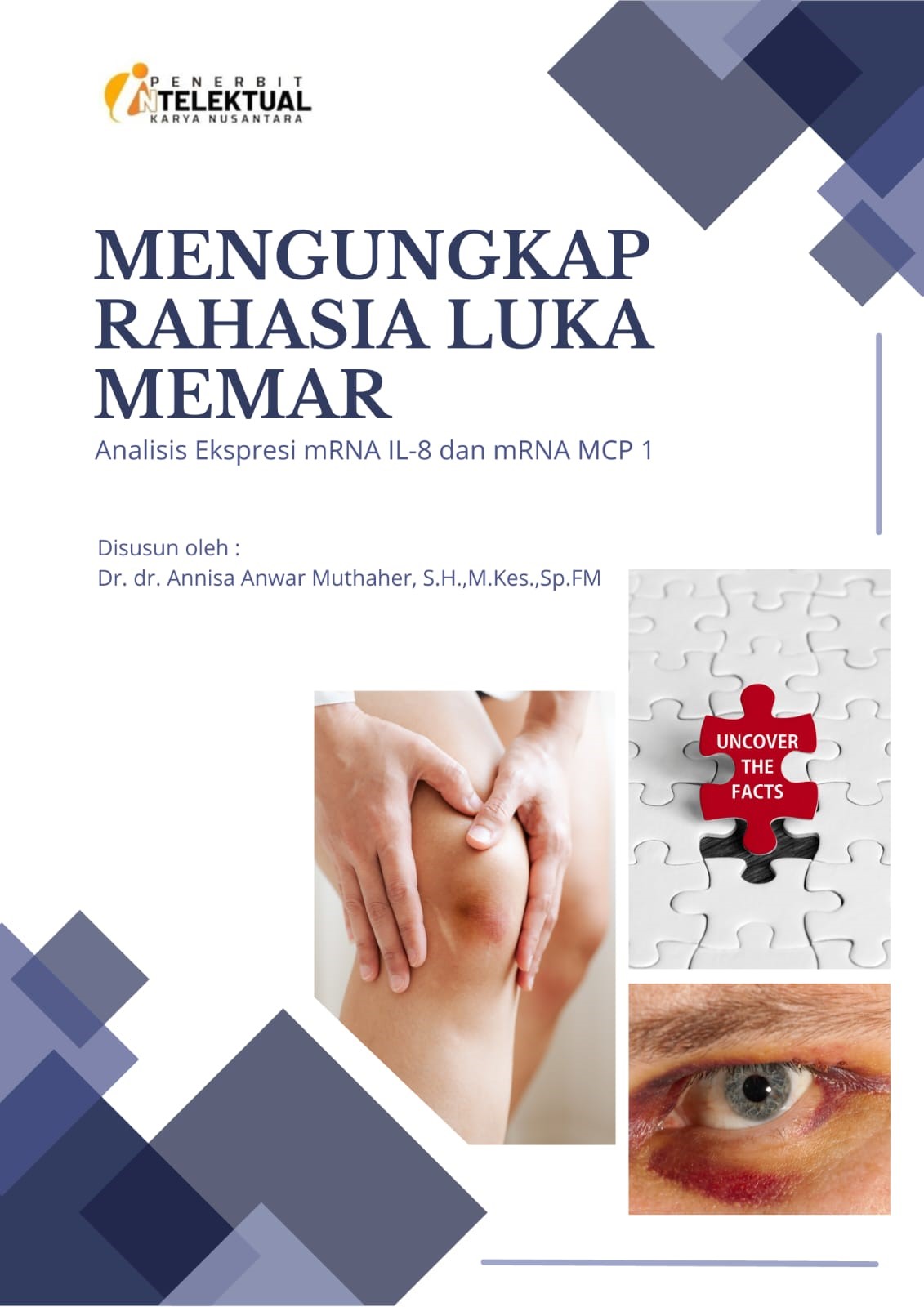 BUKU MENGUNKAP RAHASIA LUKA MEMAR ANALISIS EKSPRESI mRNA IL-8 DAN mRNA ...